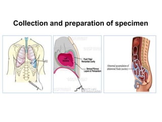 diagnostic Cytology introduction , Body fluids cytology | PPTX