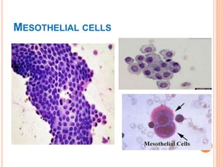 diagnostic Cytology introduction , Body fluids cytology | PPTX