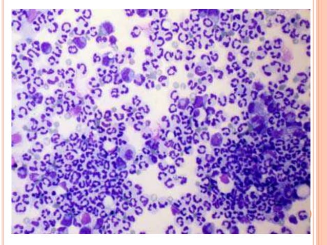 Diagnostic Cytology Introduction Body Fluids Cytology Pptx 7033