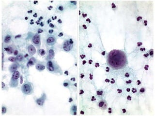 diagnostic Cytology introduction , Body fluids cytology | PPTX