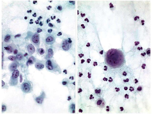 diagnostic Cytology introduction , Body fluids cytology | PPTX