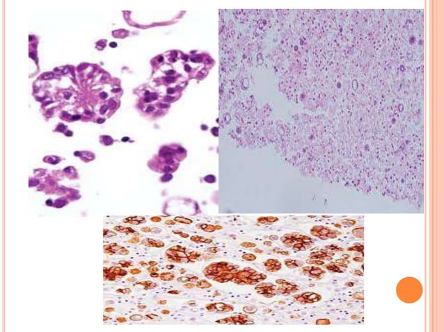 Diagnostic Cytology Introduction Body Fluids Cytology Pptx 7788