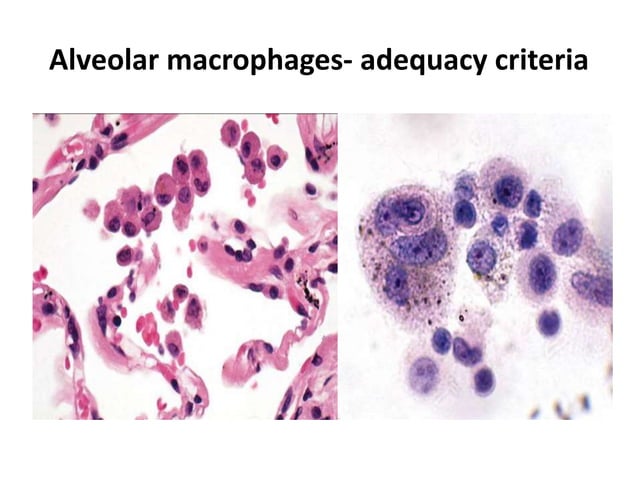 Diagnostic Cytology Introduction Body Fluids Cytology Pptx 3989