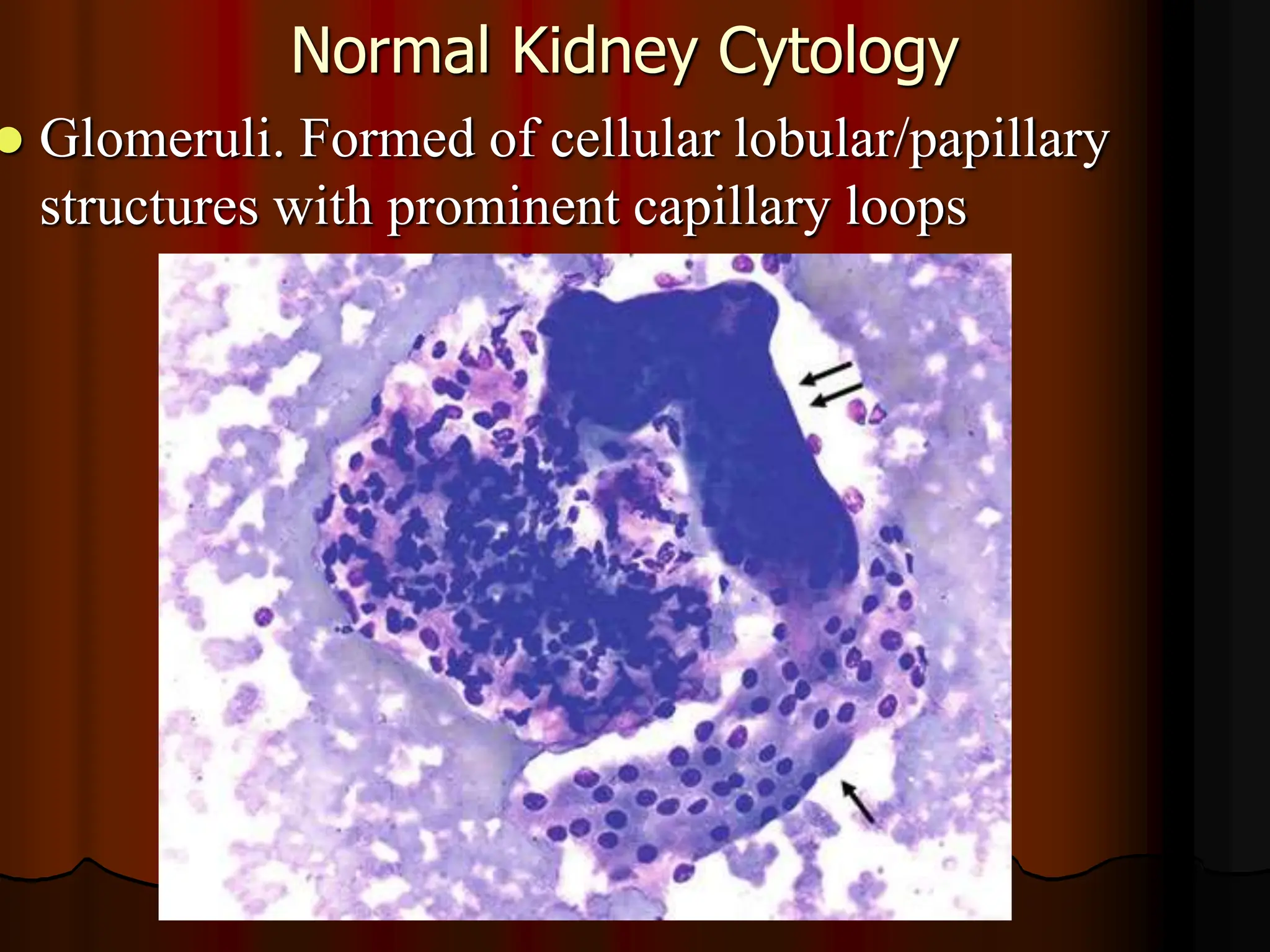 Renal cytology. Cell Morphology and identification | PPT