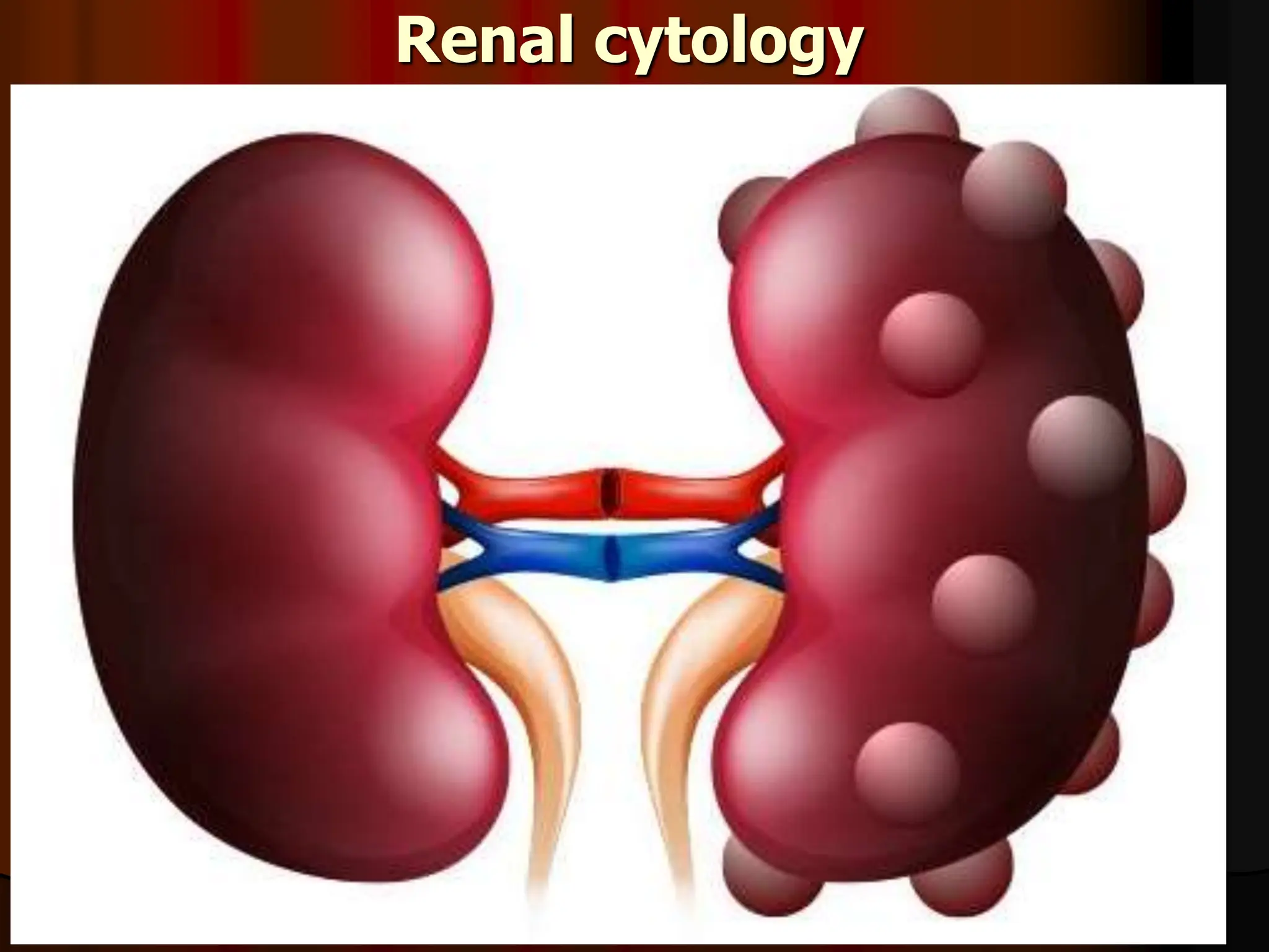 Renal cytology. Cell Morphology and identification | PPT