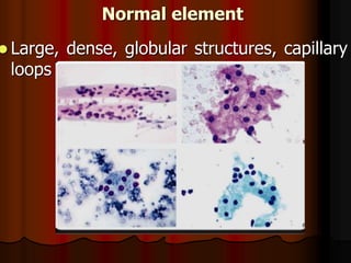 Renal cytology. Cell Morphology and identification | PPT
