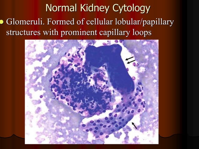 Renal cytology. Cell Morphology and identification | PPT