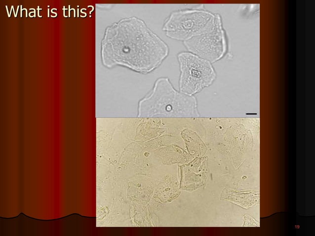 Renal cytology. Cell Morphology and identification | PPT