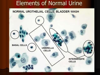 Renal cytology. Cell Morphology and identification | PPT