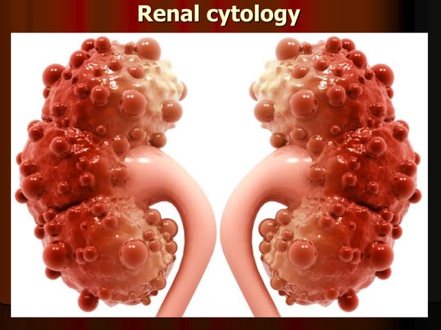 Renal cytology. Cell Morphology and identification | PPT
