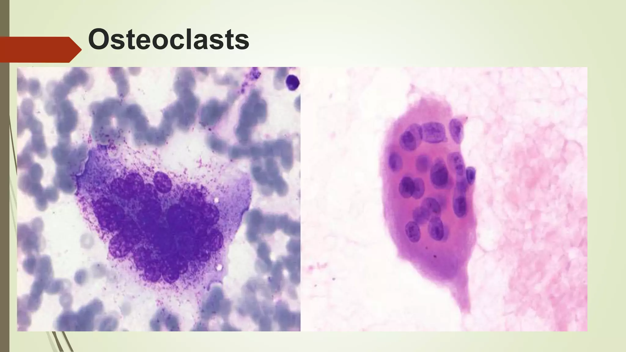 Cytology of bone lesions | PPTX