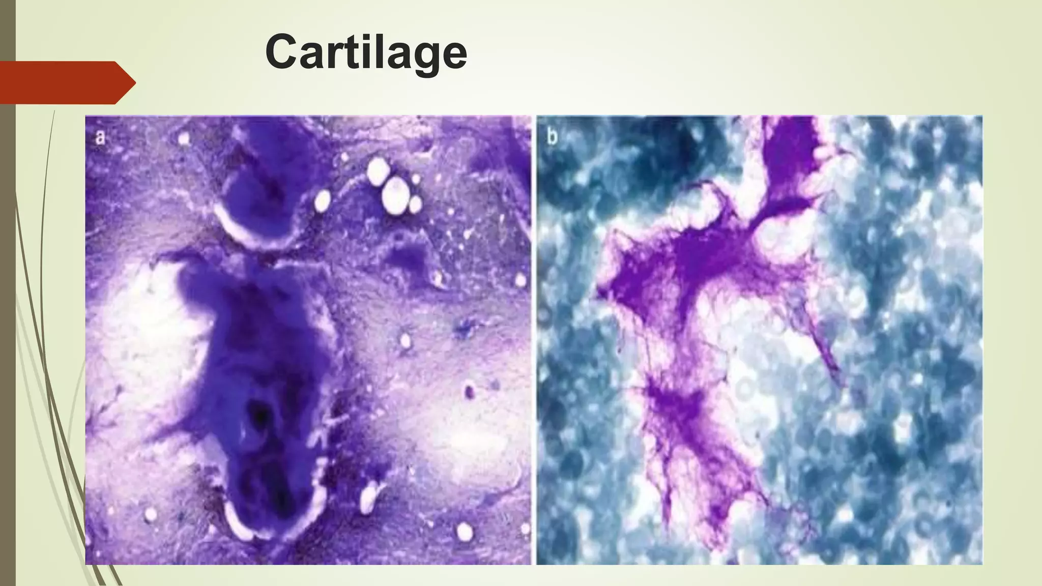 Cytology of bone lesions | PPTX