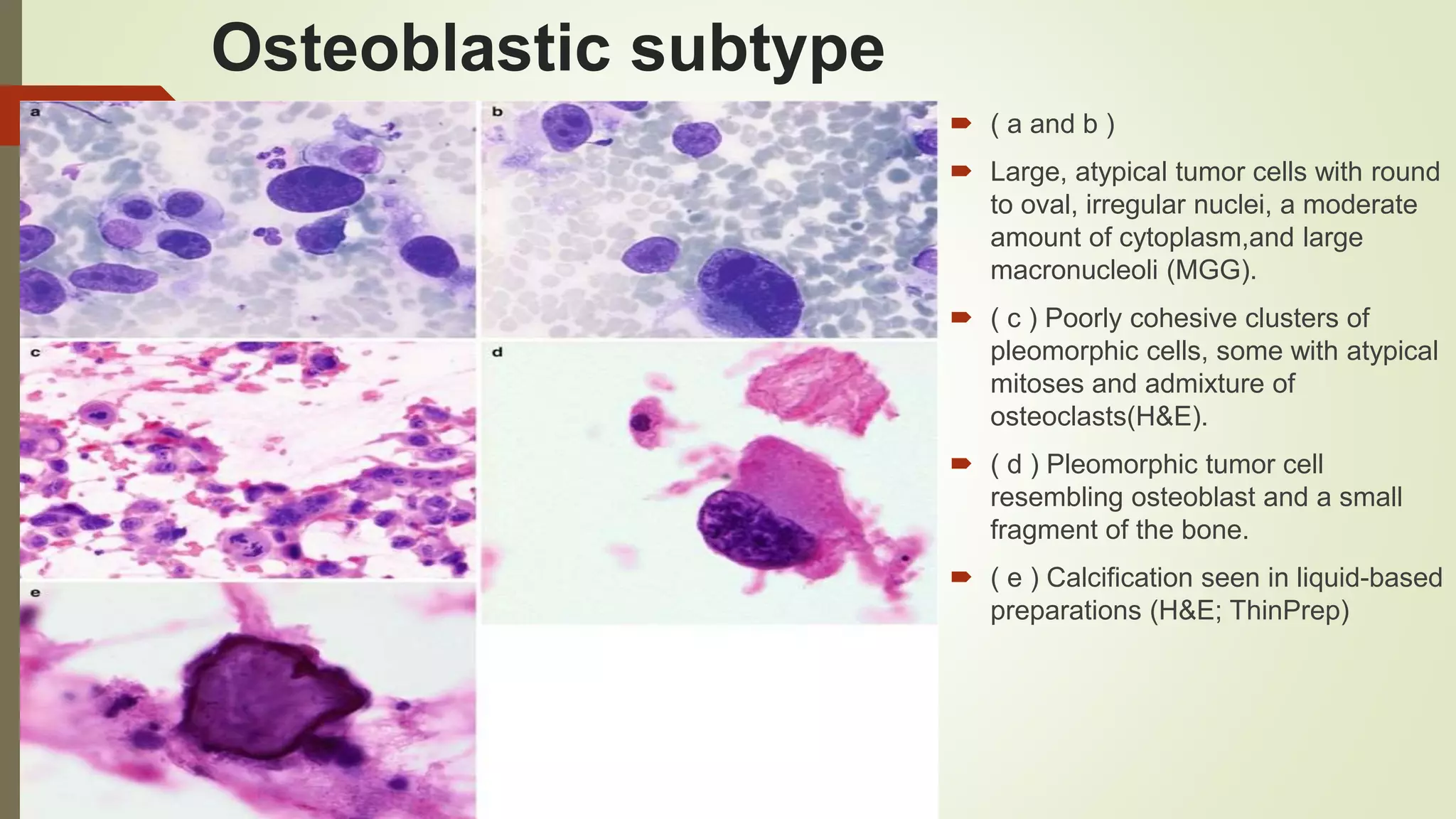 Cytology of bone lesions | PPTX