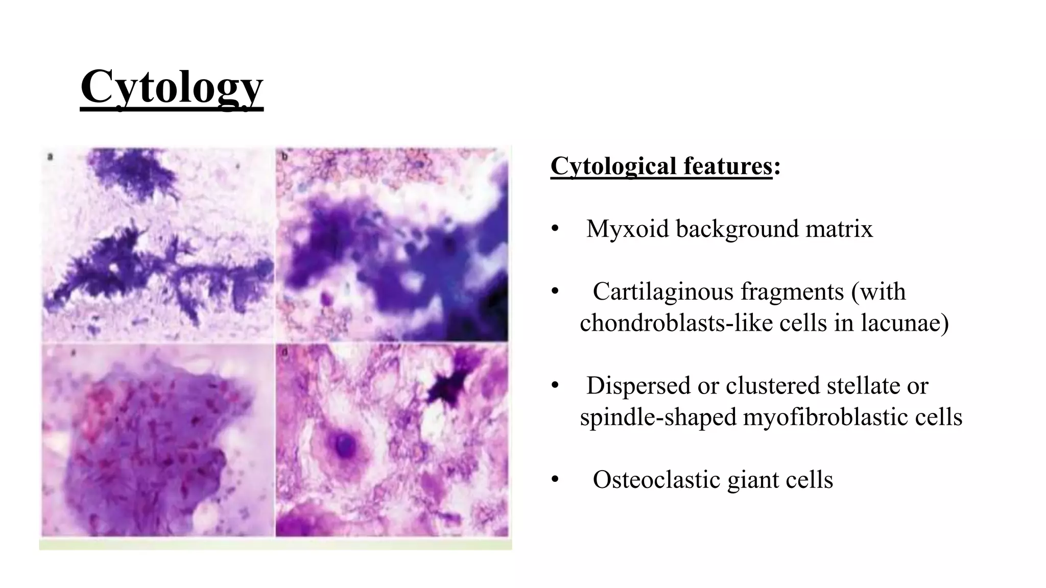 CYTOLOGY OF BONE LESIONS.pptx