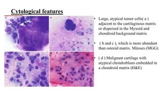 CYTOLOGY OF BONE LESIONS.pptx