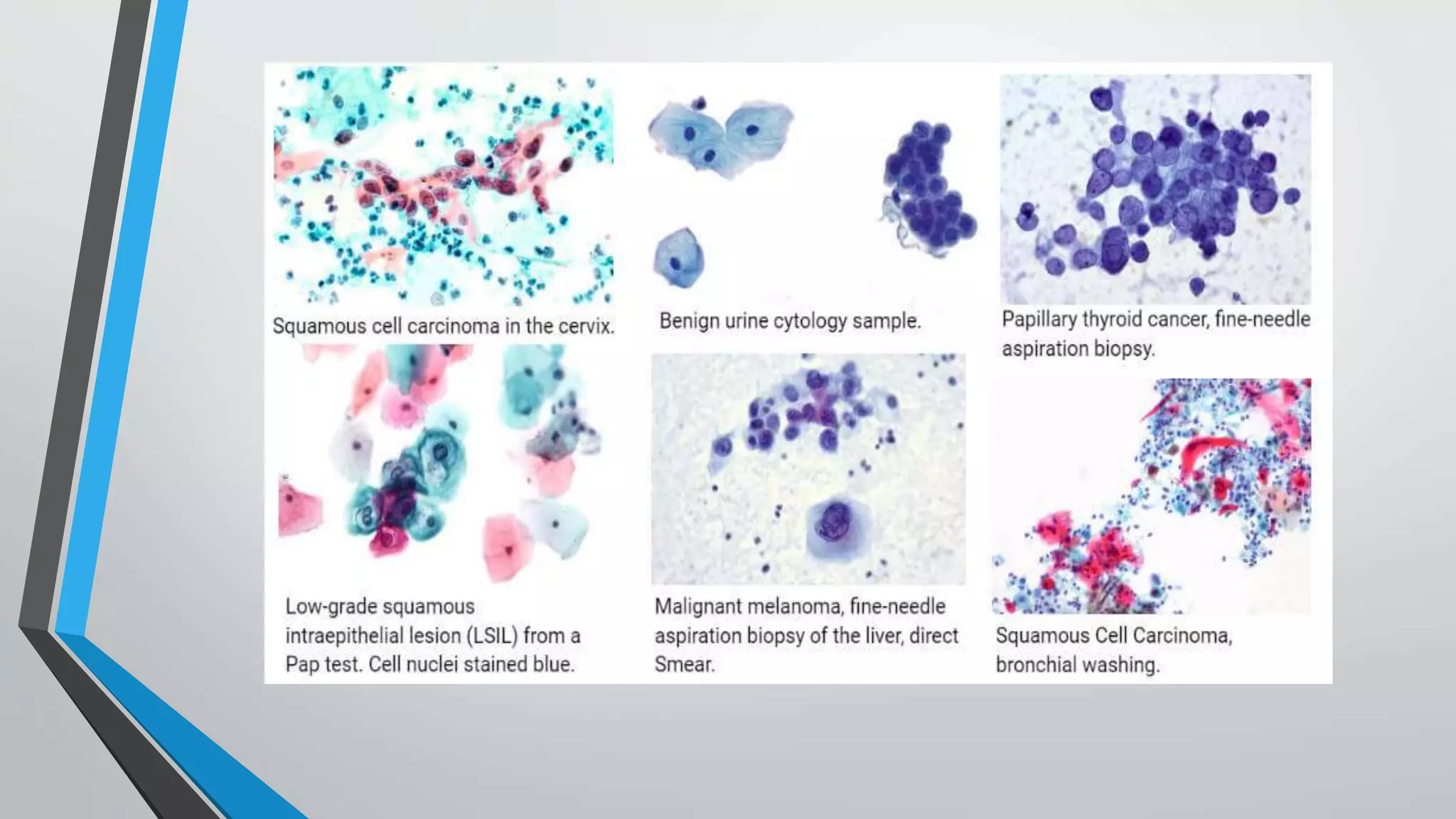 CYTOLOGY PPT.pptx