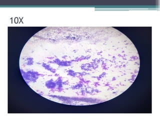 CYTOLOGY SLIDE DISCUSSION presentation for pathology | PPTX