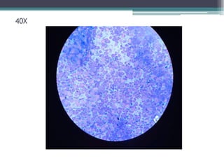 CYTOLOGY SLIDE DISCUSSION presentation for pathology | PPTX