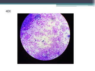 CYTOLOGY SLIDE DISCUSSION presentation for pathology | PPTX