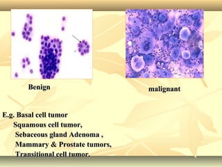 Basal Cell Tumor Dog Cytology