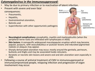 Cytomegalovirus Made Very Easy! | PPTX