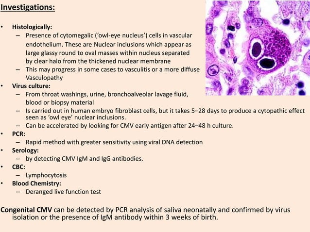 Cytomegalovirus Made Very Easy! | PPTX | Infectious Diseases | Diseases ...