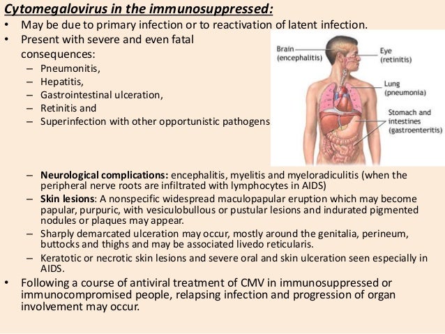 Cytomegalovirus Made Very Easy