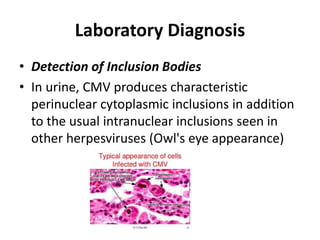 CYTOMEGALOVIRUS.pptx for educational purposes | PPTX | Infectious ...