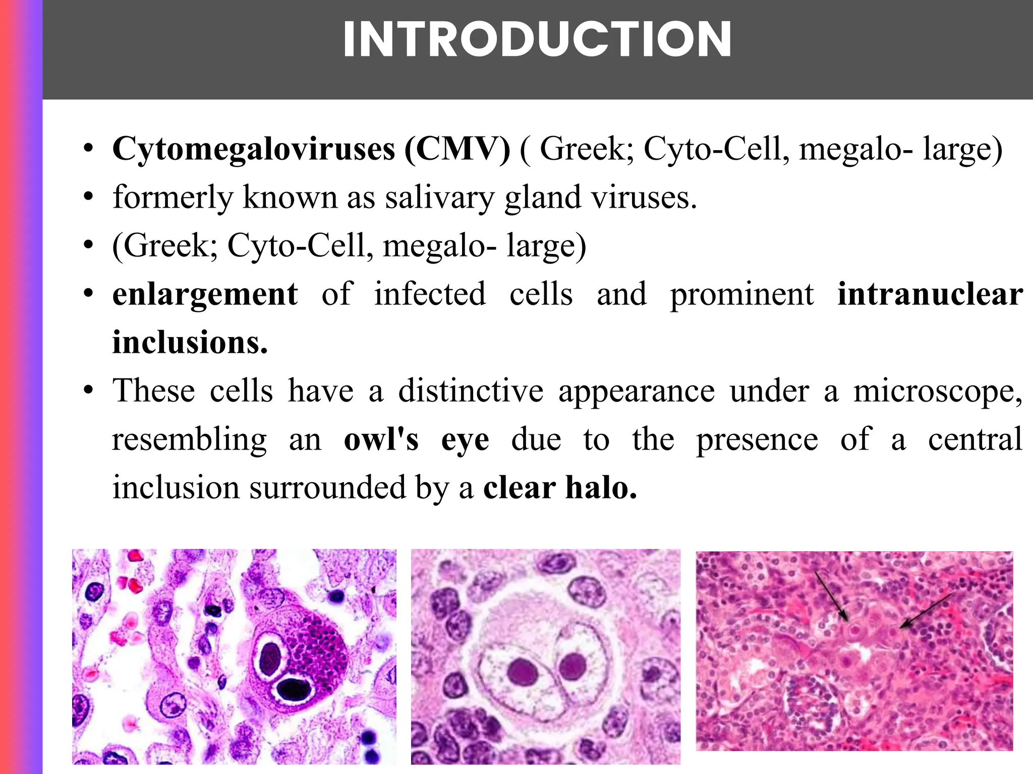 Microbiology of Cytomegalovirus (Herpes).pptx