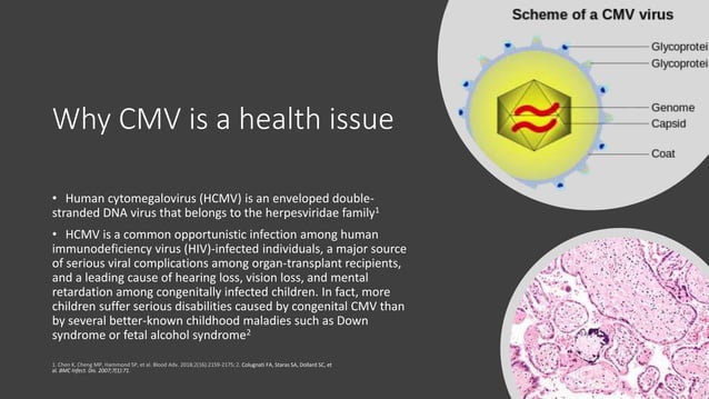 Cytomegalovirus infection in critically ill patients: Focus on HSCT ...