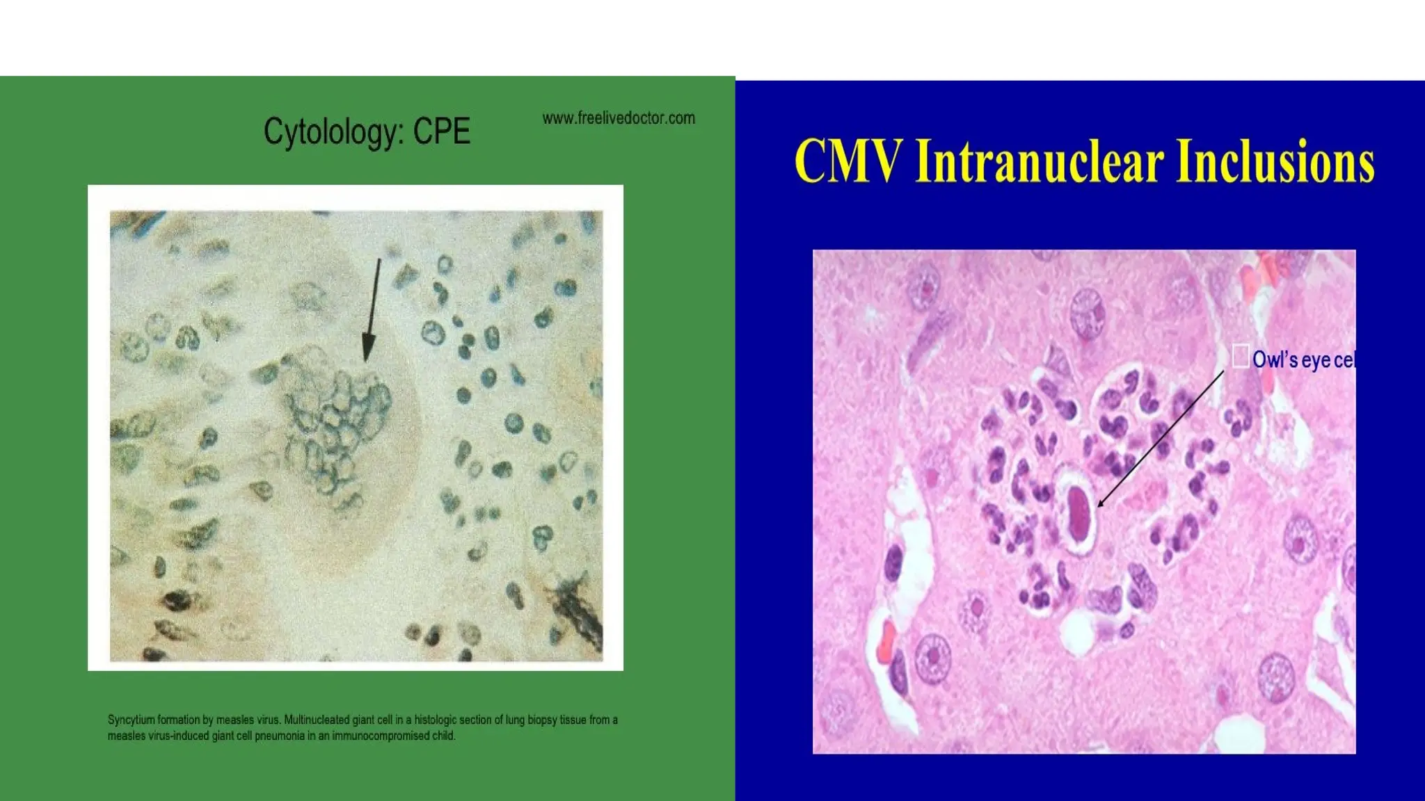 cytopathic effect notes by SANJU SAH.pptx