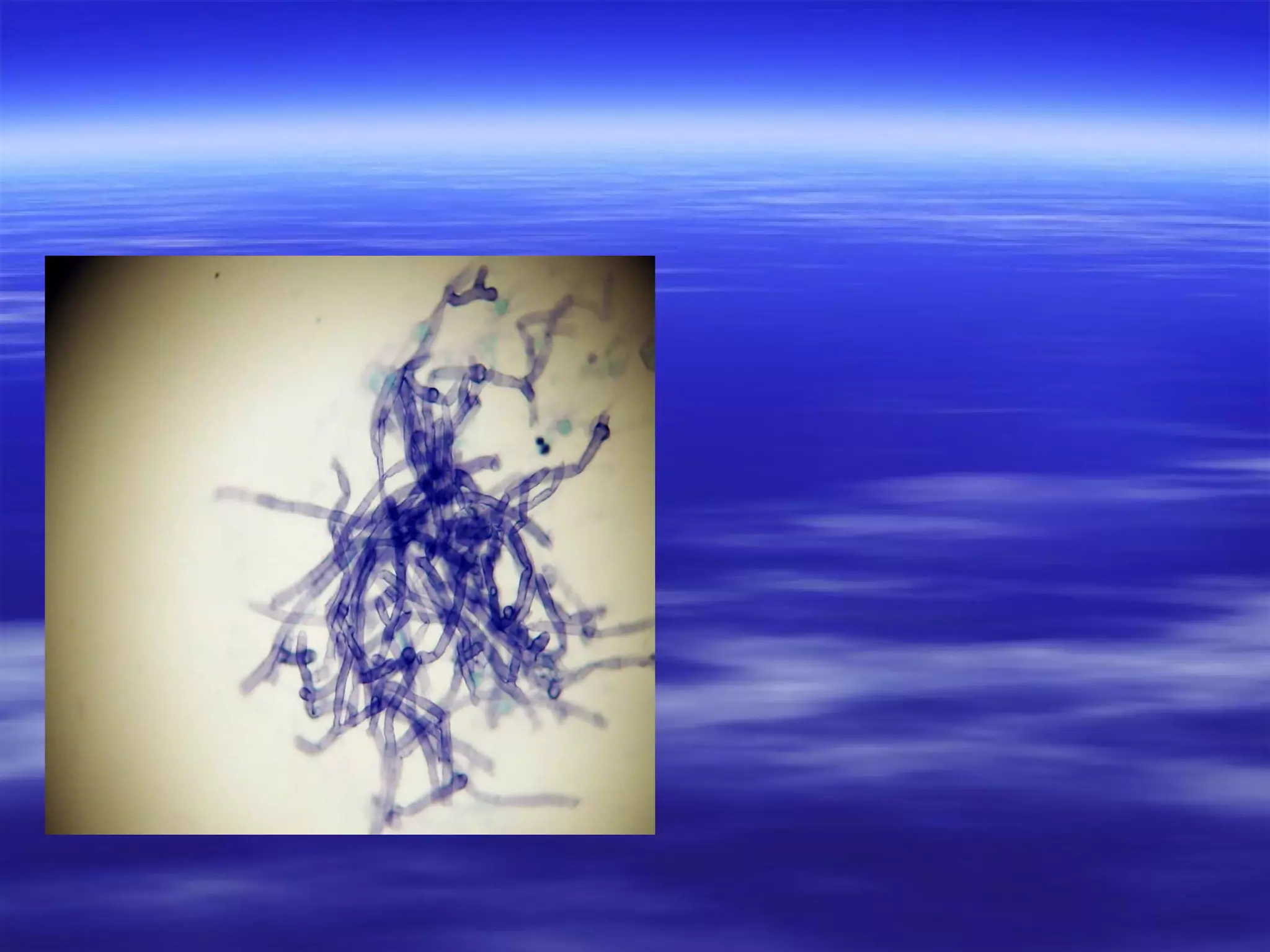 Cytopathic Effects Of Viral Infections | PPT