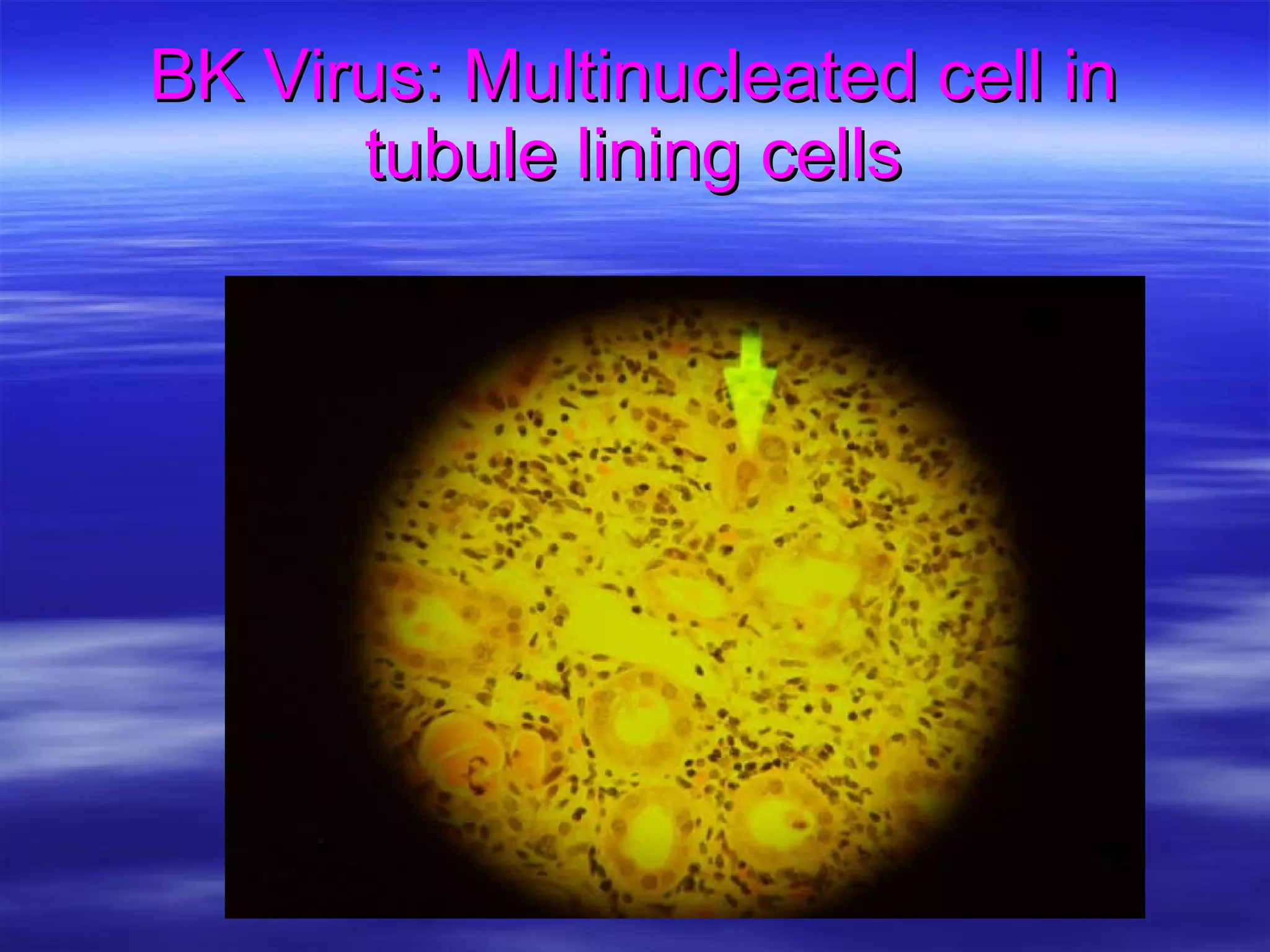 Cytopathic Effects Of Viral Infections | PPT