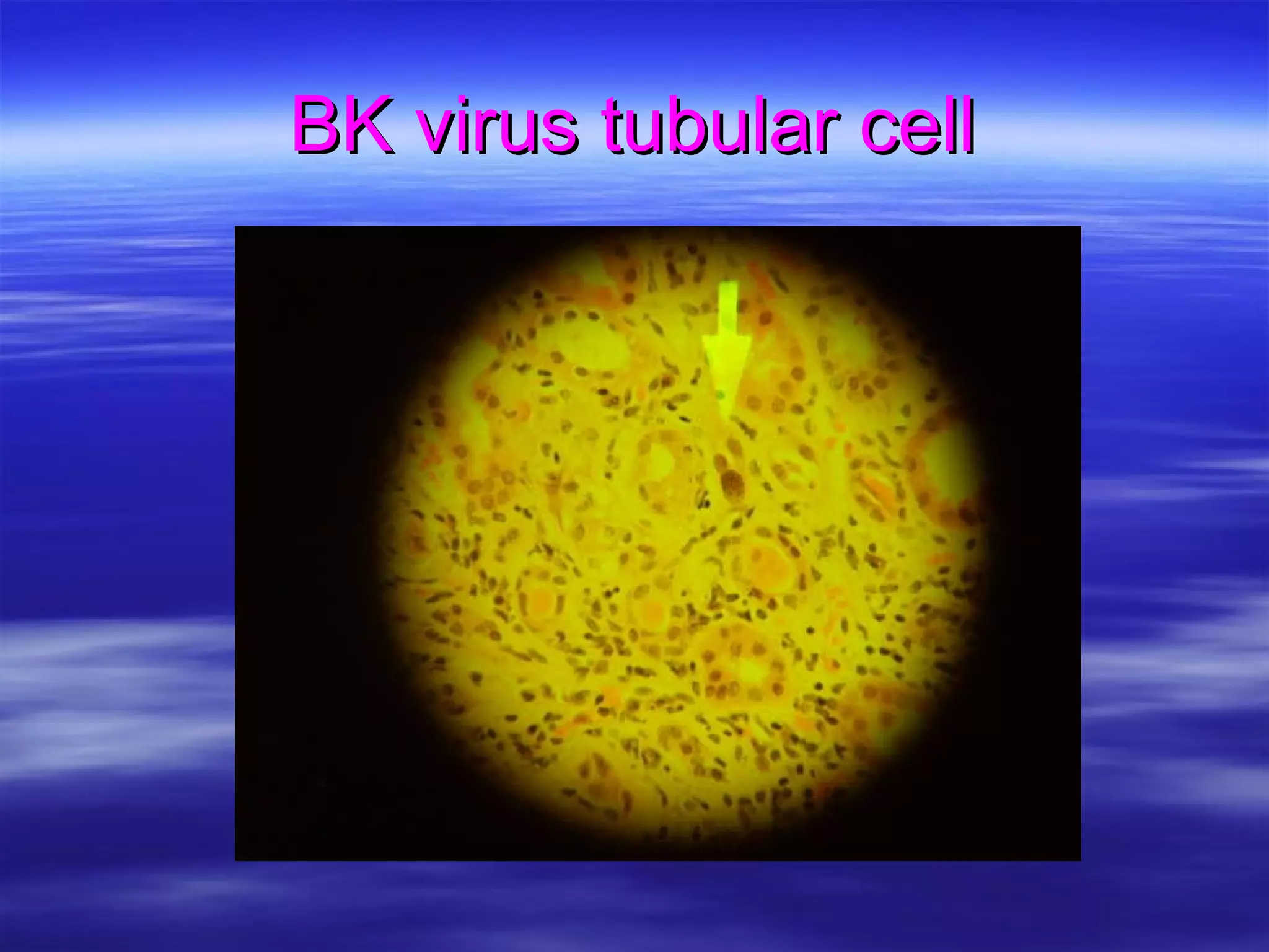 Cytopathic Effects Of Viral Infections | PPT