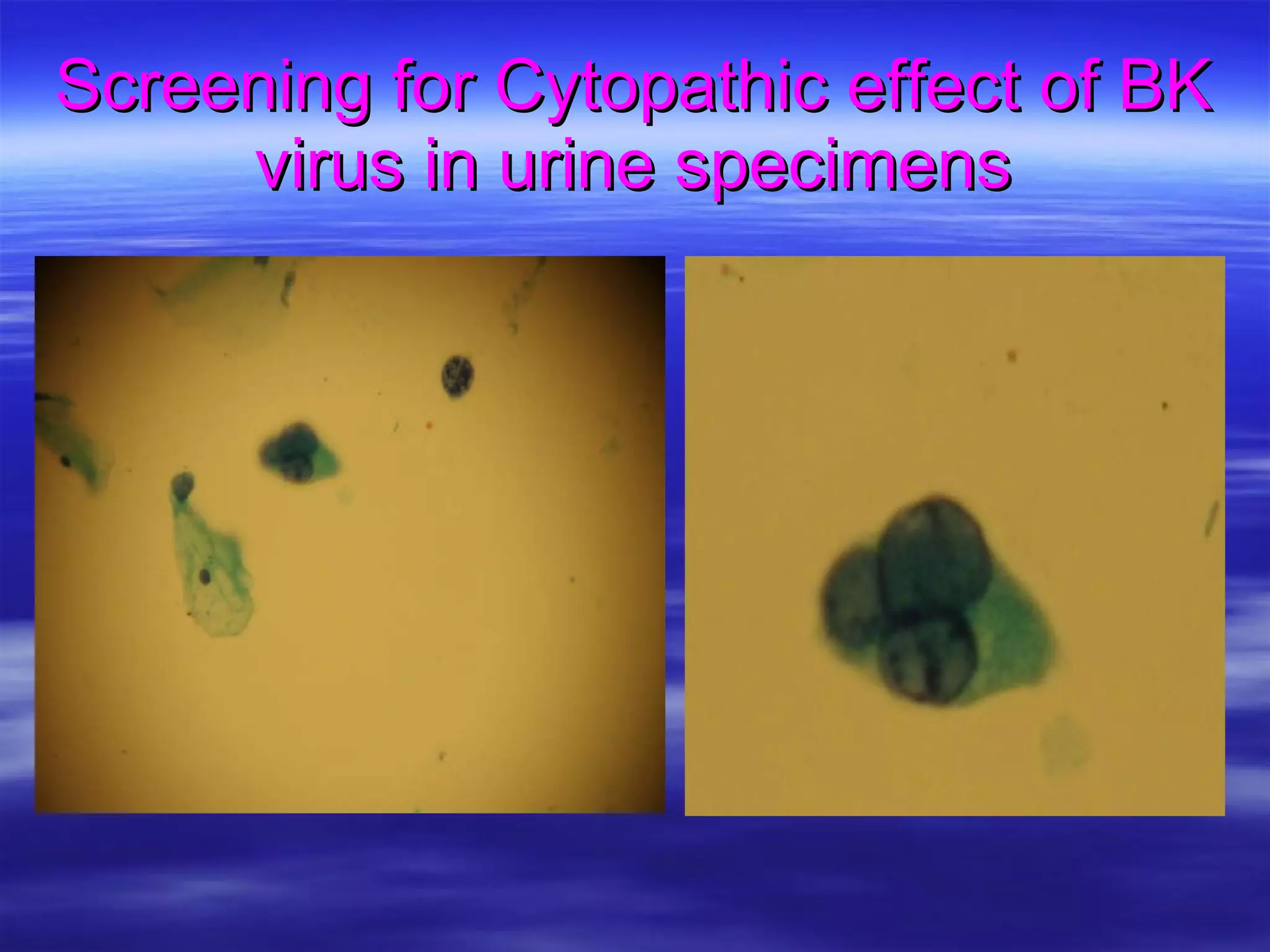 Cytopathic Effects Of Viral Infections | PPT