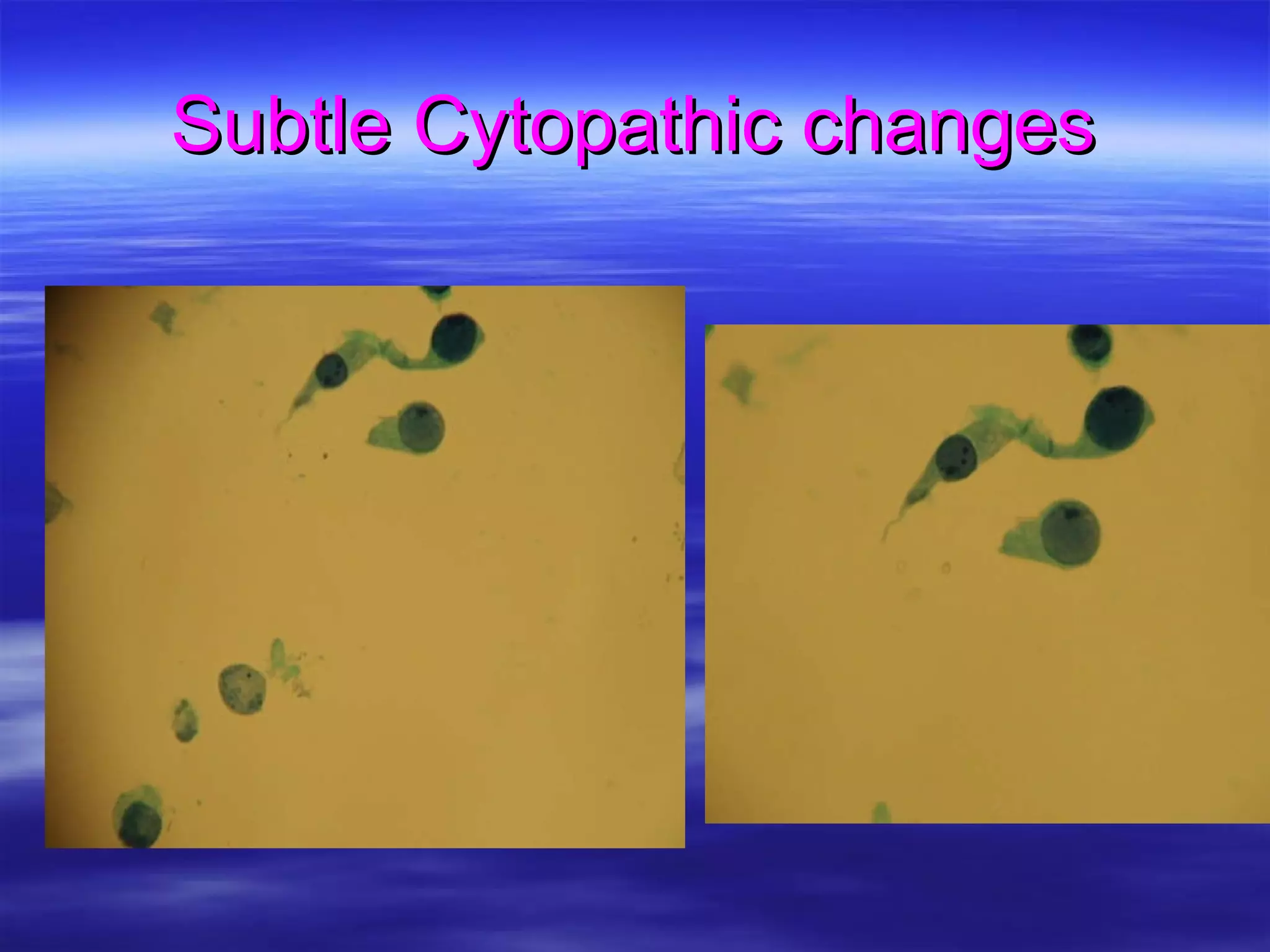 Cytopathic Effects Of Viral Infections | PPT