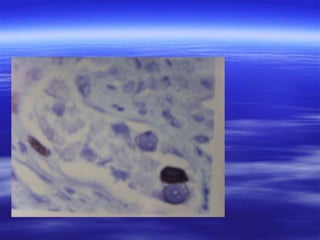 Cytopathic Effects Of Viral Infections | PPT