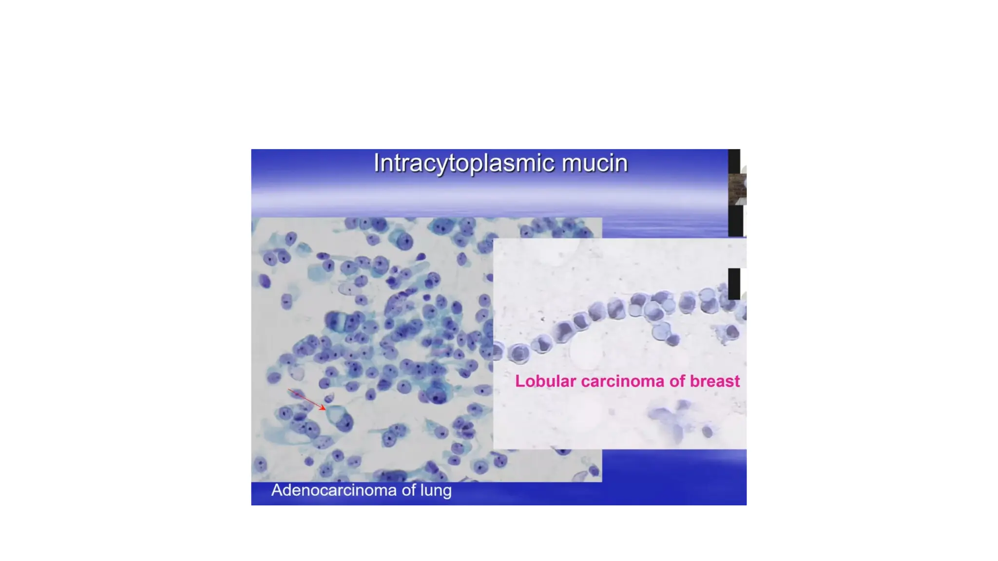 Cytopathology 101. For beginners of cytology | PPTX
