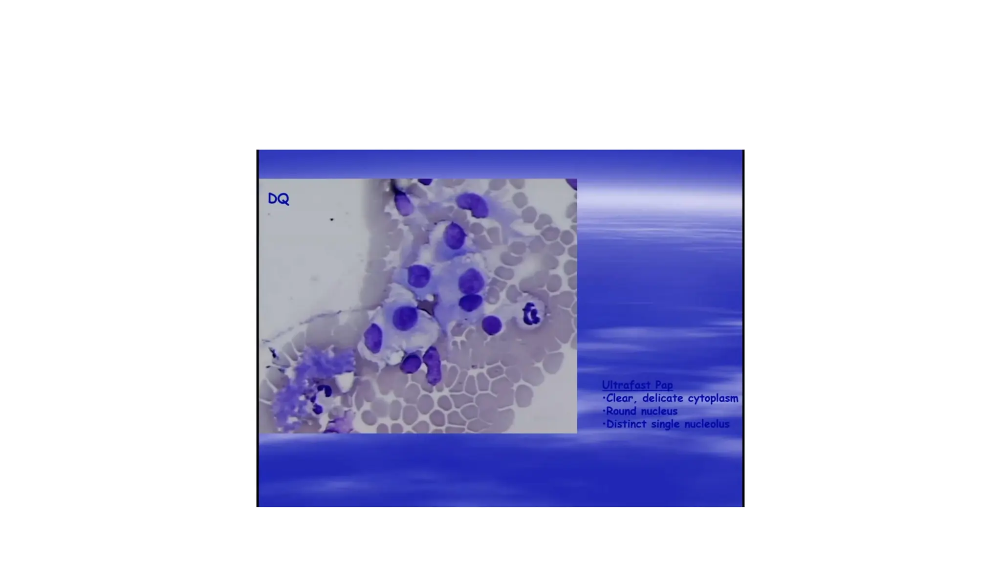 Cytopathology 101. For beginners of cytology | PPTX | Cancer | Diseases and Conditions