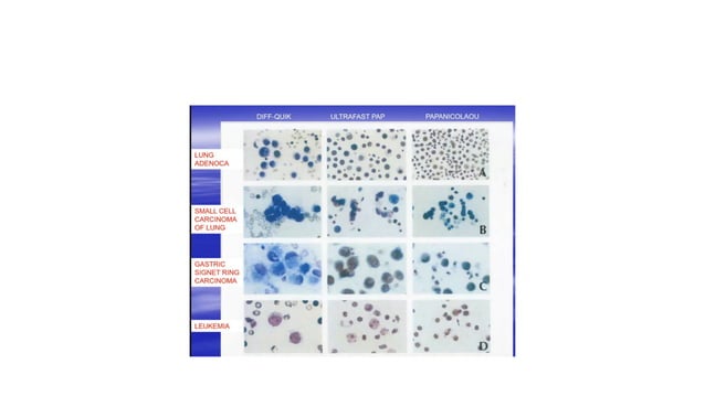 Cytopathology 101. For beginners of cytology | PPTX | Cancer | Diseases ...