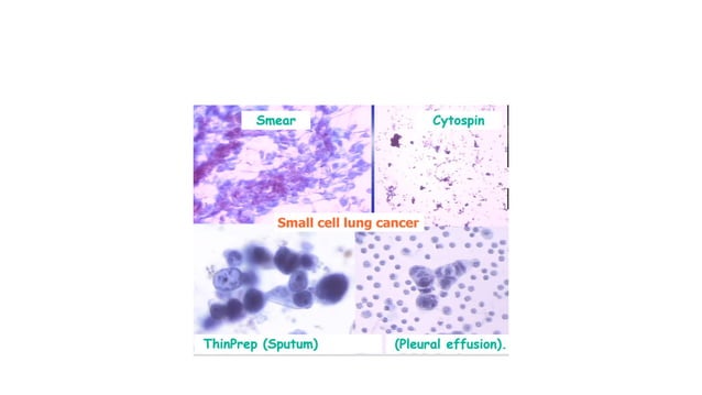 Cytopathology 101. For beginners of cytology | PPTX | Cancer | Diseases and Conditions