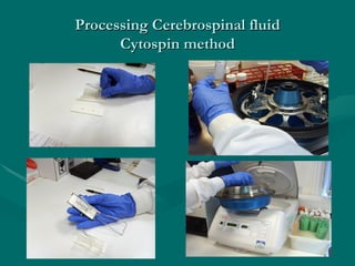 Cytopathology Of Cerebrospinal Fluid[1]Power Point | PPT