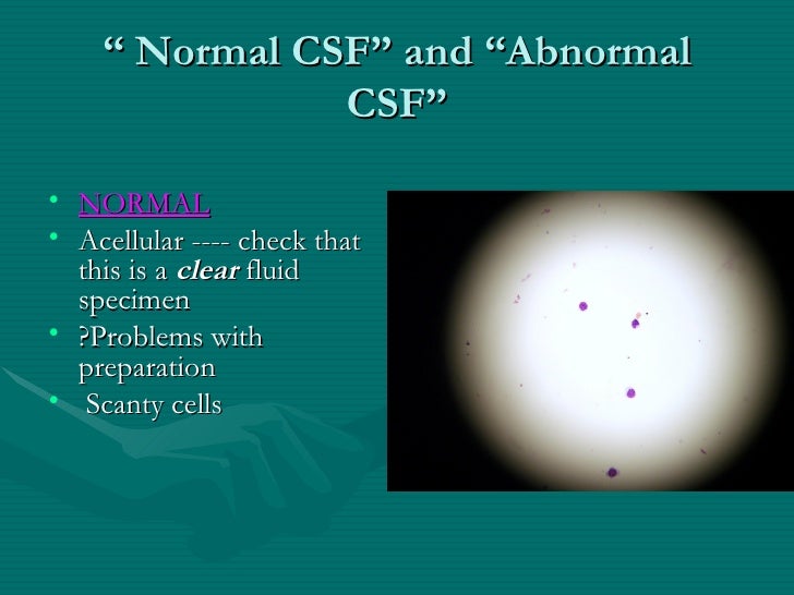 Cytopathology Of Cerebrospinal Fluid[1]Power Point
