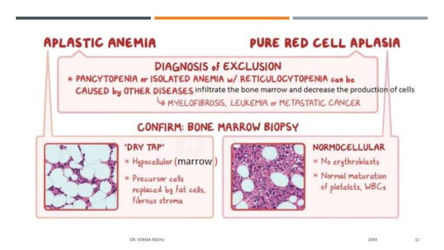 Cytopenia | PPTX