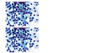 LBC Cytology Non-Gyne mixed slides.pptx