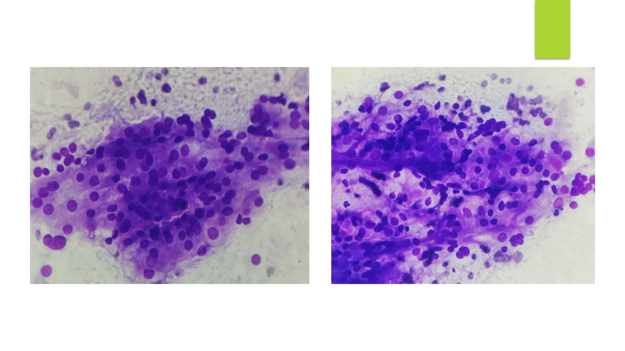 Cytology Slide Disscussion presentation for pathology | PPTX
