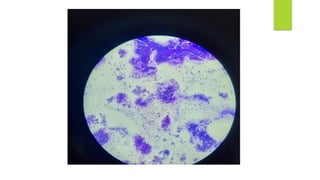 Cytology Slide Disscussion presentation for pathology | PPTX