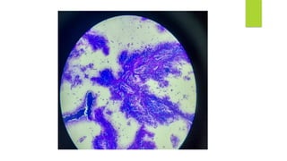 Cytology Slide Disscussion presentation for pathology | PPTX