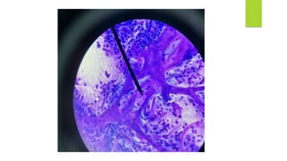 Cytology Slide Disscussion presentation for pathology | PPTX