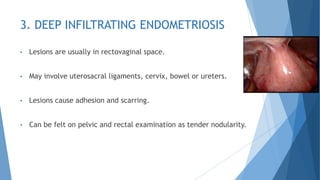 Endometriosis | PPTX